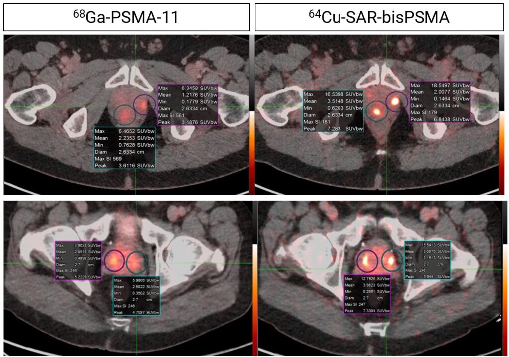 Clarity and PSI kick off SAR-bisPSMA Phase III - Clarity ...